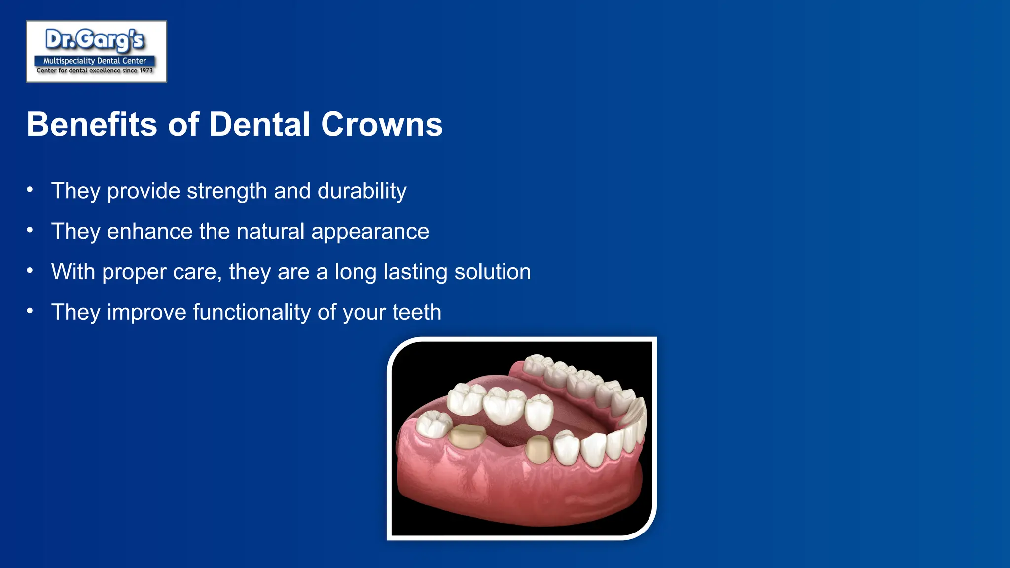 Durability Meets Beauty The Advantage of Dental Crowns.pptx