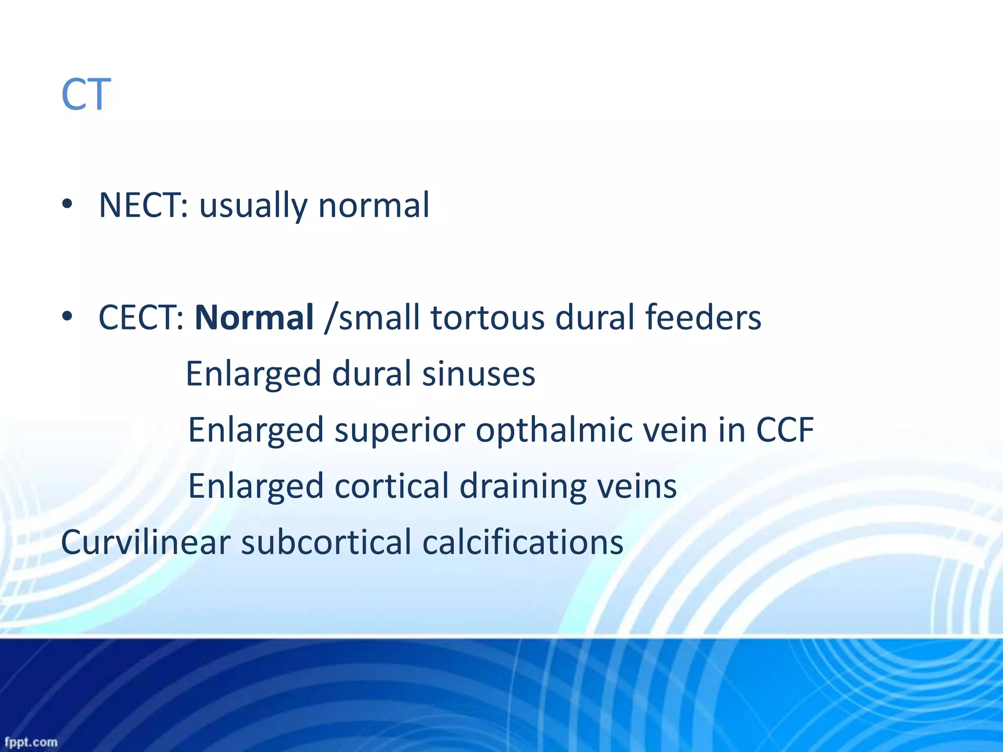 Dural arteriovenous fistula & AVM | PPTX