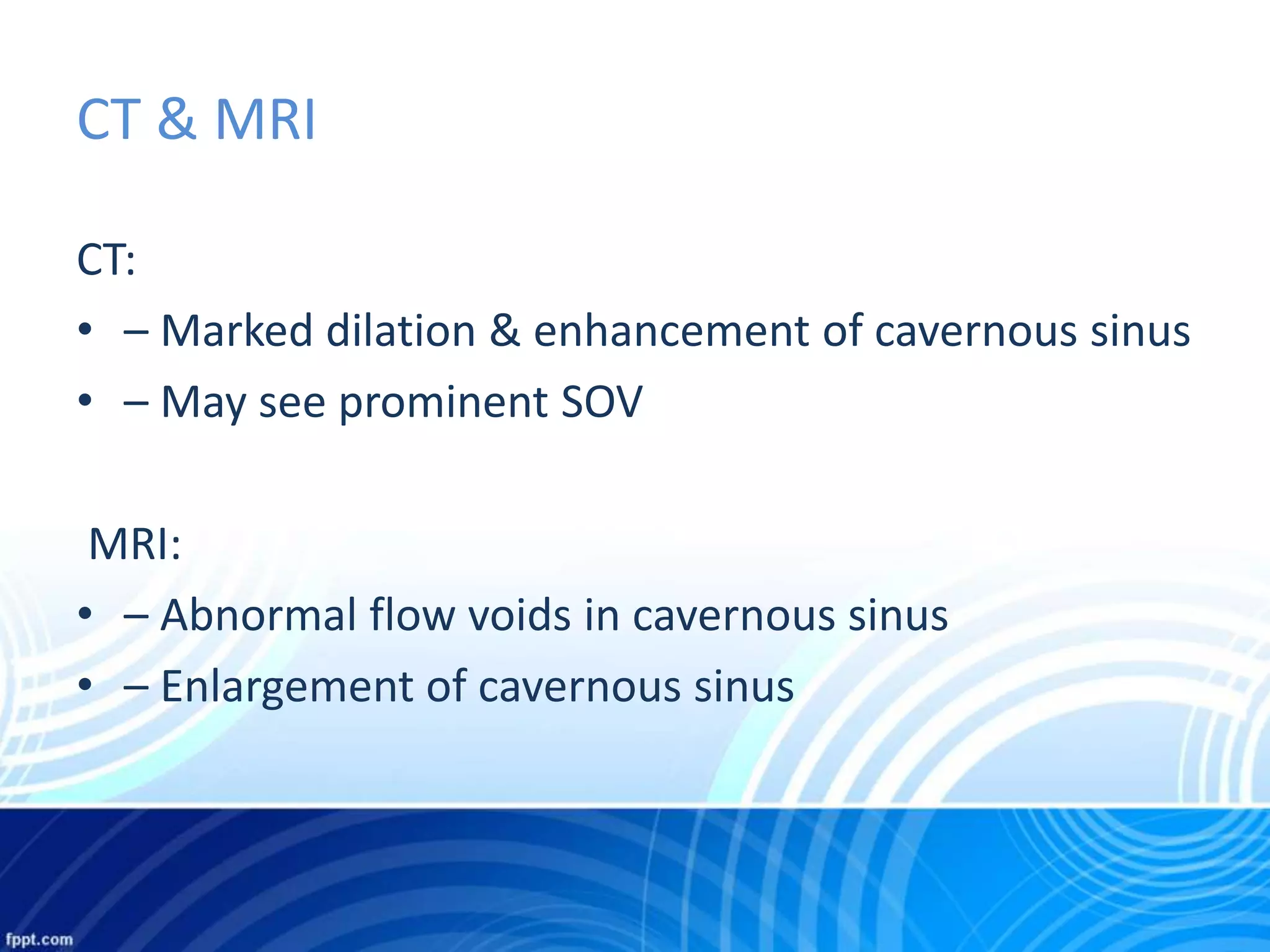 Dural arteriovenous fistula & AVM | PPTX