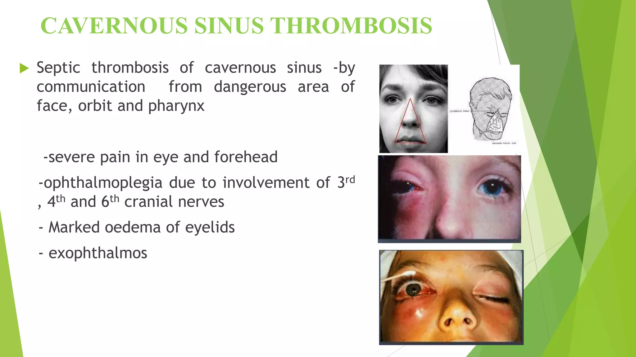 Dural folds and cavernous sinus | PPTX