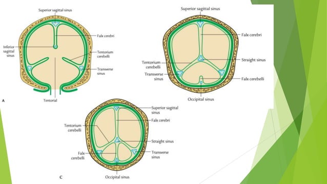 Dural folds and cavernous sinus | PPTX | Death, Injury, or Military ...
