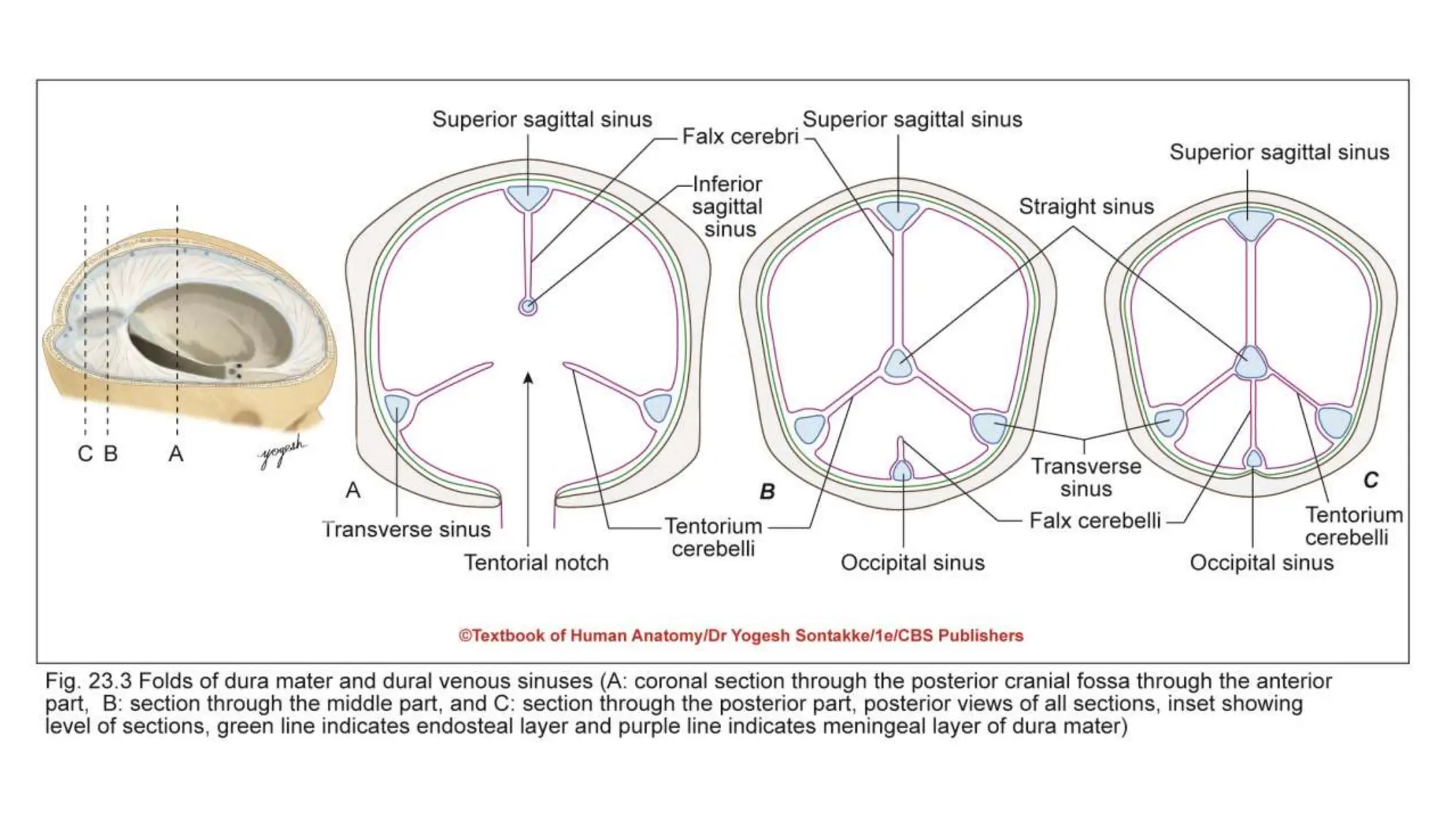 DURAL FOLDS AND DURAL VENOUS SINUS ,APPLIED ASPECTS | PPT