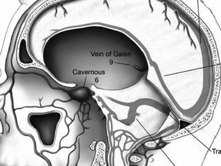 Dural venous sinuses, Ankur Saxena | PPTX