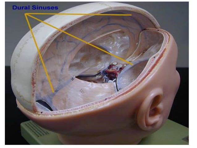 Dural venous sinuses, Ankur Saxena | PPT
