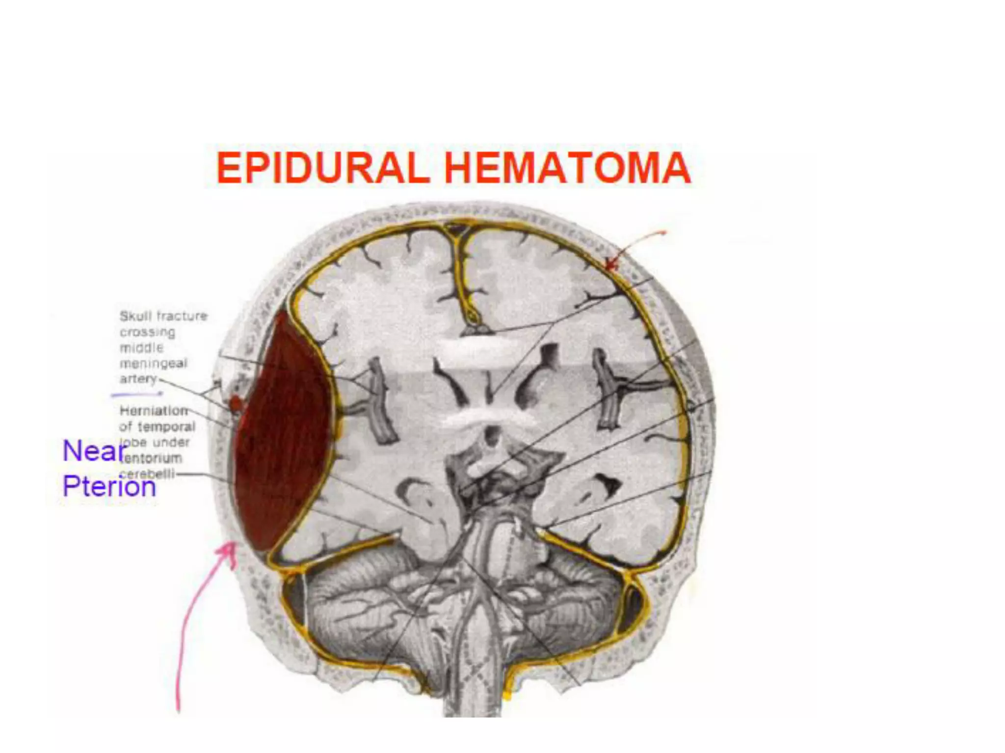 Dural venous sinuses | PDF