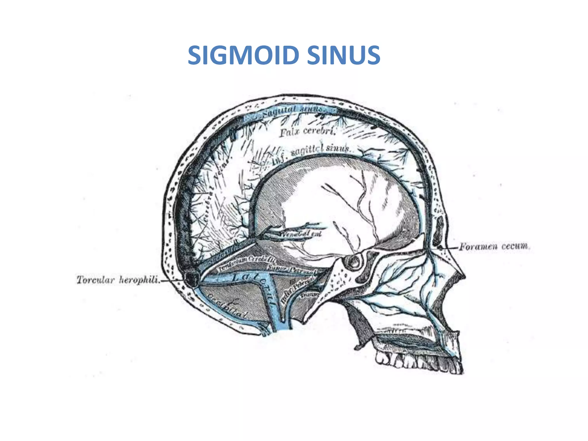 DURAL VENOUS SINUSES WITH CLINICAL ANATOMY 2021 | PPTX