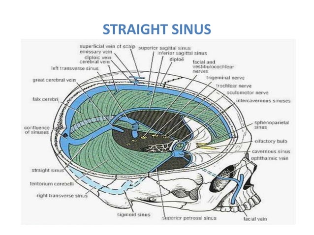 DURAL VENOUS SINUSES WITH CLINICAL ANATOMY 2021 | PPTX | Death, Injury, or Military Conflict ...