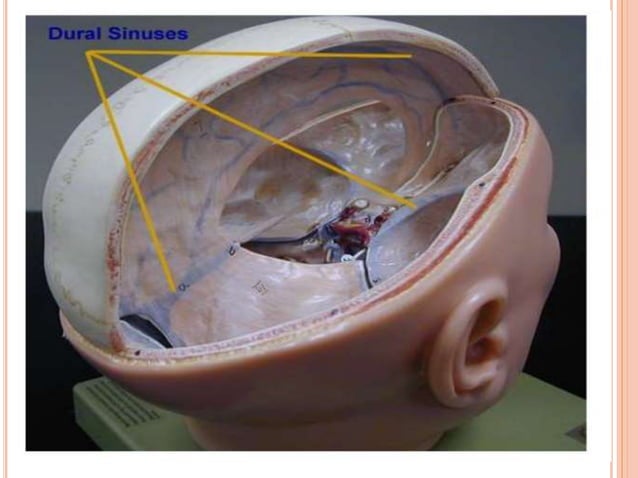 Dural venous sinuses | PPTX | Ear, Nose and Throat Conditions ...