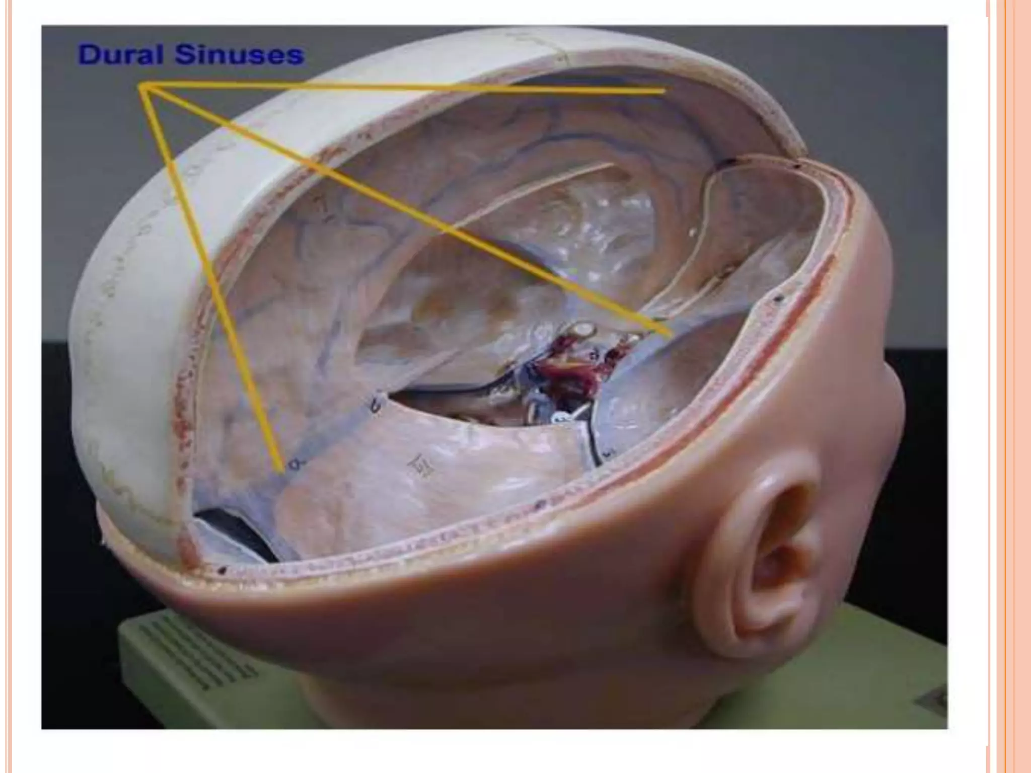 Dural venous sinuses & cavernous sinus | PPTX