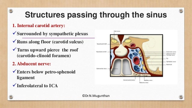 Cavernous Sinus Netter