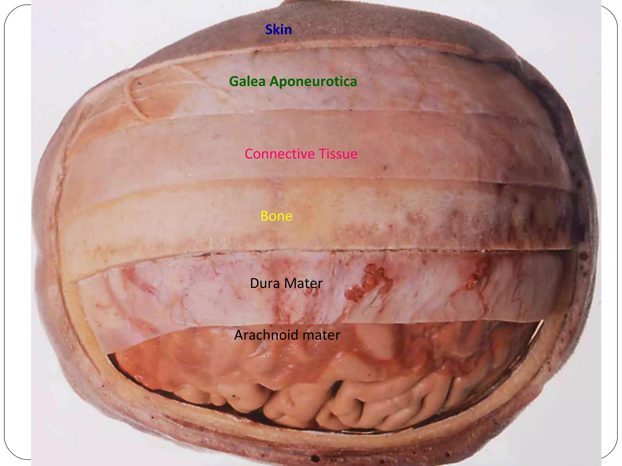 Dural vs pratik | PPT