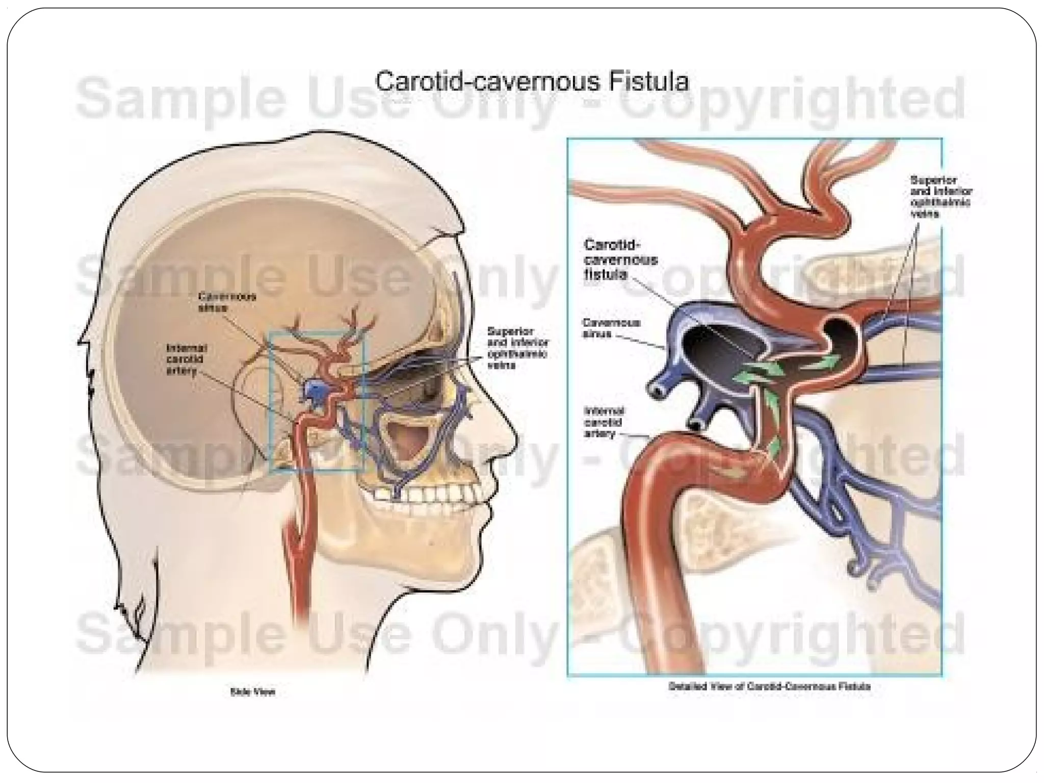 Dural vs pratik | PPT