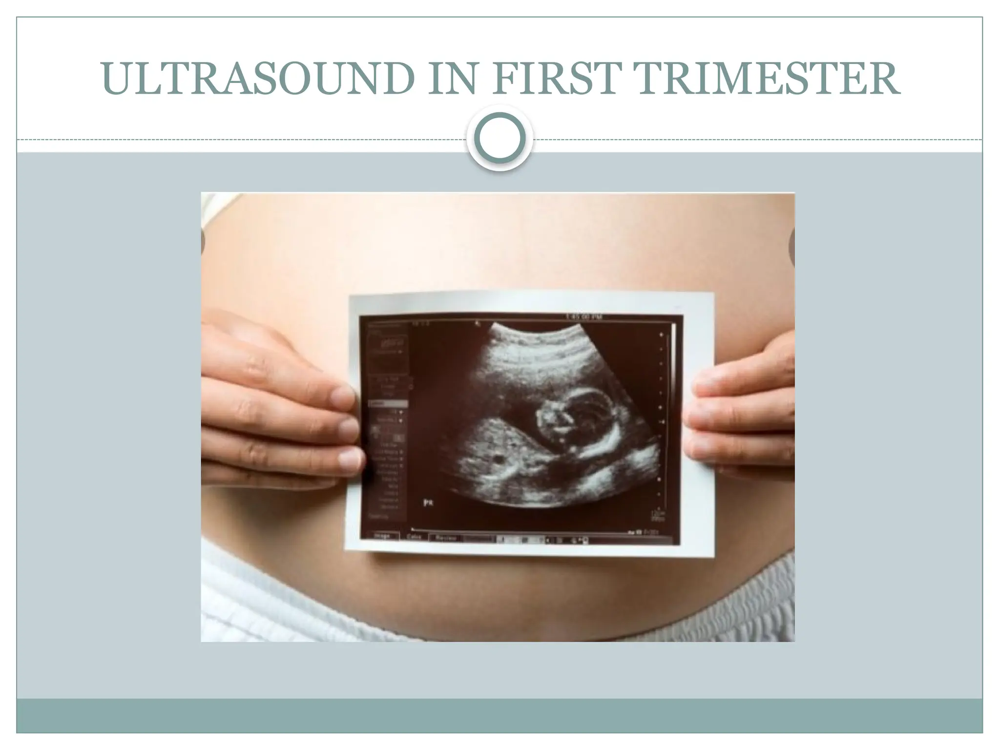 Ultrasonography for first trimester women.pptx
