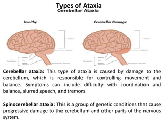 Dushyant Verma - Ataxia What It Is, Causes, Symptoms, Treatment & Types ...