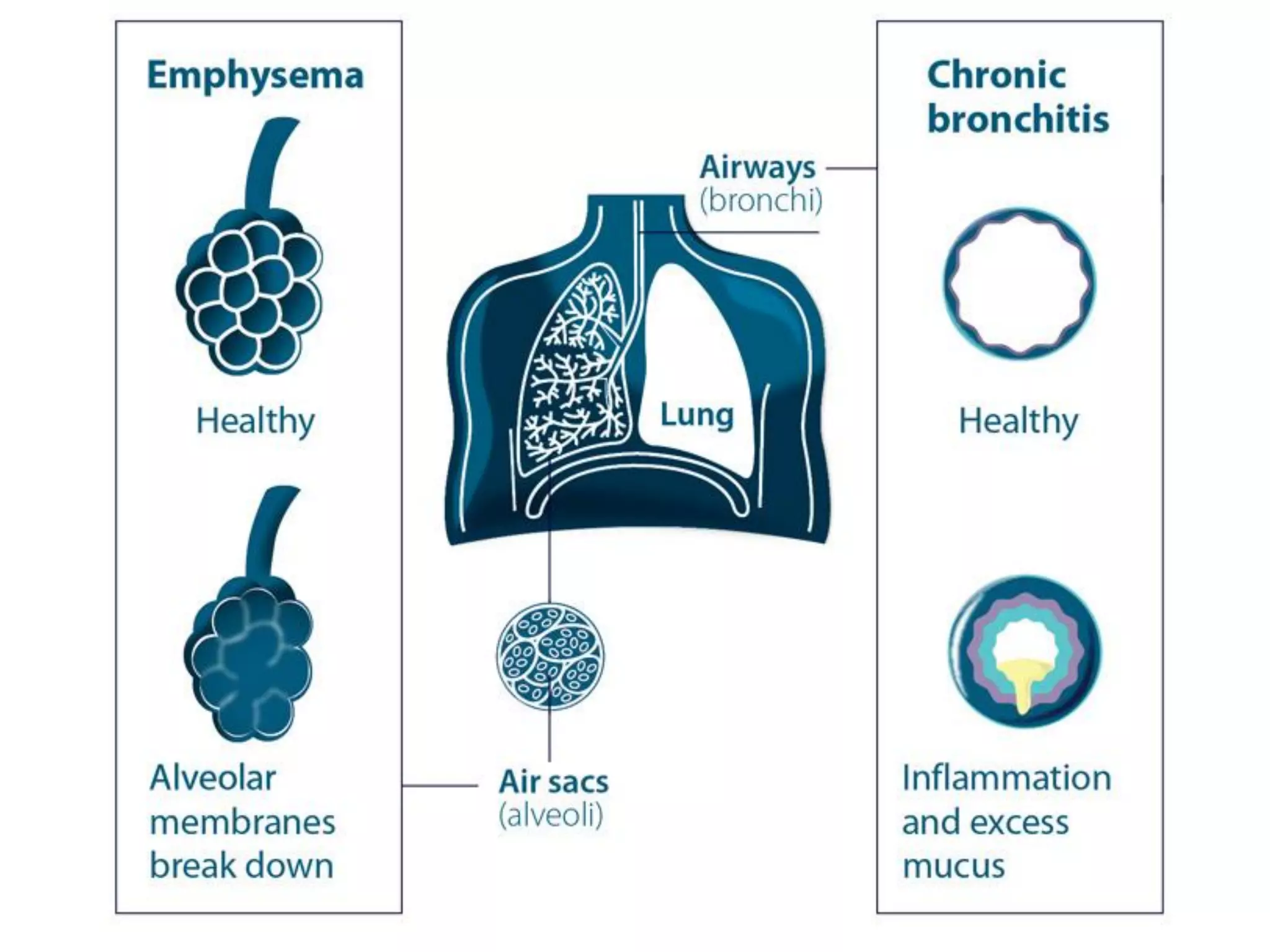 Dust exposure, effects, limits, control | PDF
