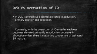 DVD | PPTX | Eye and Vision Conditions | Diseases and Conditions