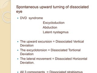 Dissociated vertical deviation | PPTX
