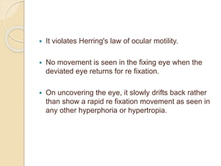 Dissociated vertical deviation | PPTX | Eye and Vision Conditions ...
