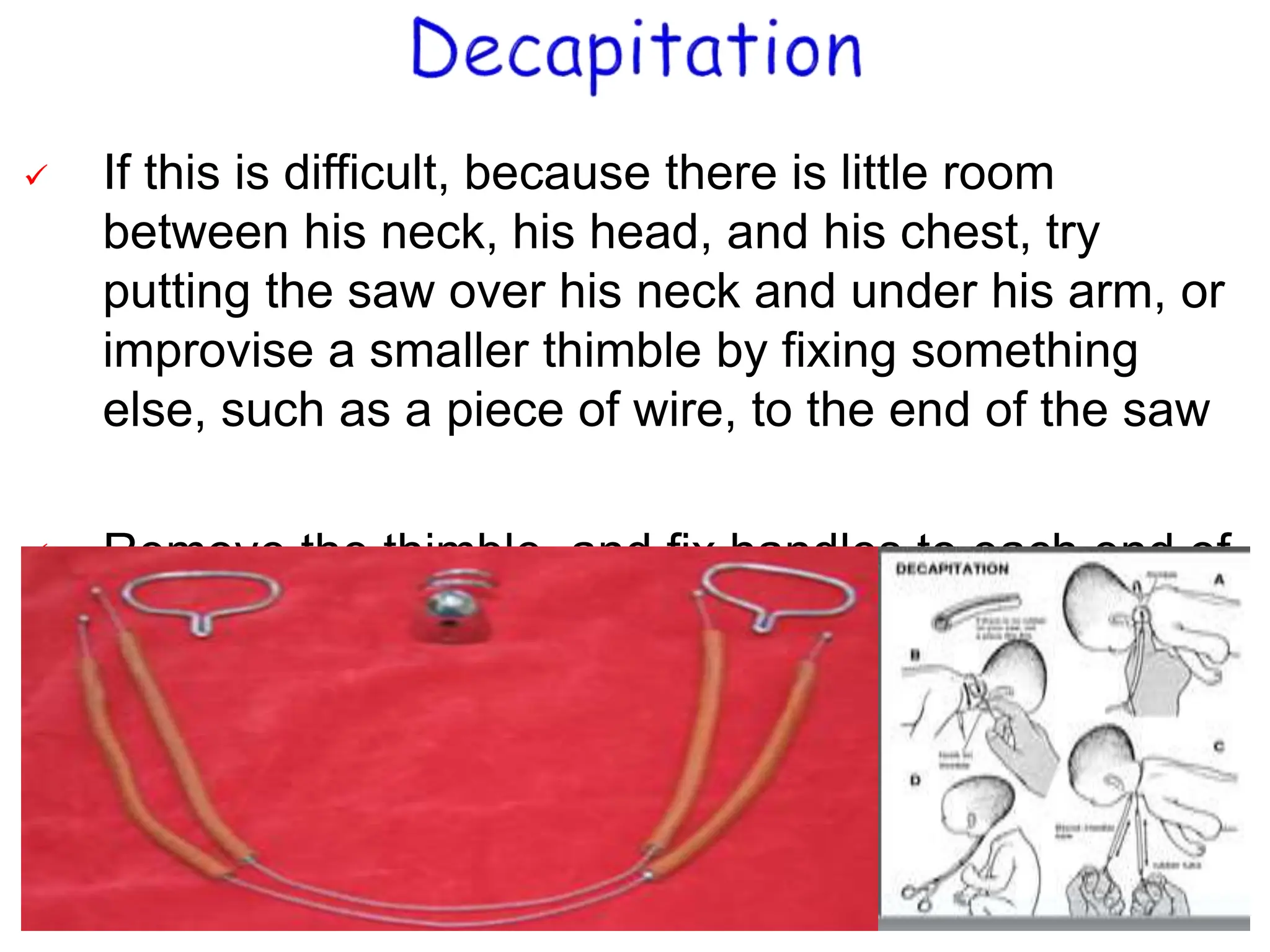 destructive vaginal delivery in gynecology | PPTX