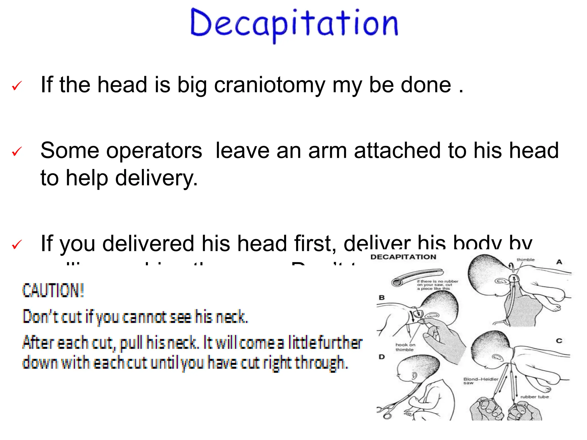 destructive vaginal delivery in gynecology | PPTX