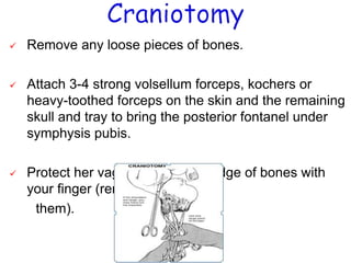 destructive vaginal delivery in gynecology | PPTX