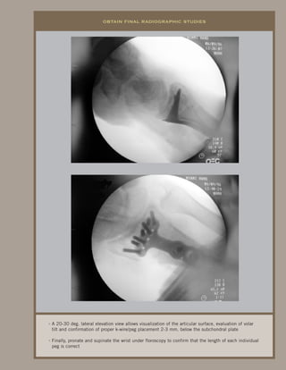 Dvr digital radius | PDF