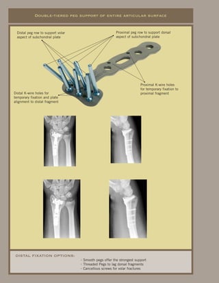 Dvr digital radius | PDF