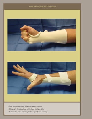 Dvr digital radius | PDF