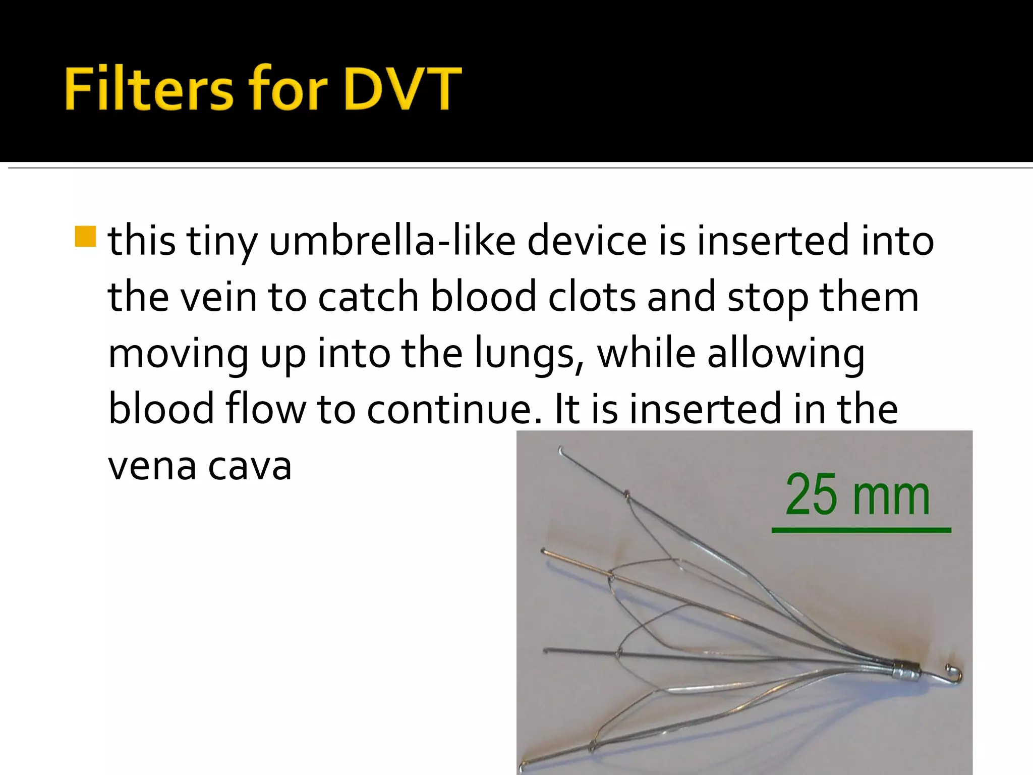 Dvt Deep Venous Thrombosis | PPT