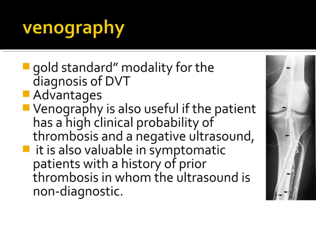 Dvt Deep Venous Thrombosis | PPT | Blood Disorders | Diseases and ...