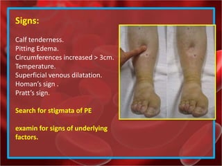 DVT.. Deep vein thrombosis. | PPTX