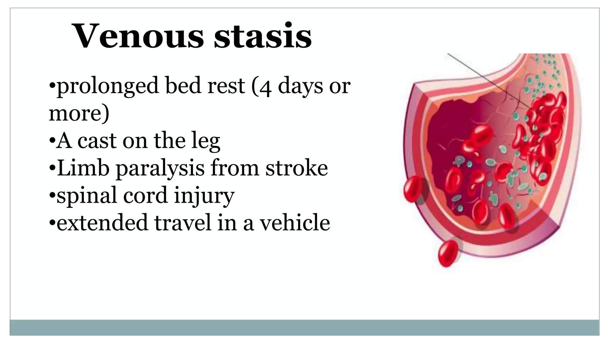 DEEP VEIN THROMBOSIS | PPTX