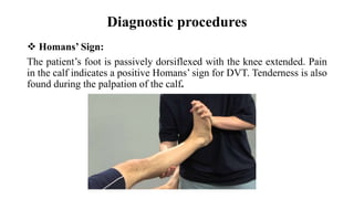 Deep Venous Thrombosis (DVT) | PPT
