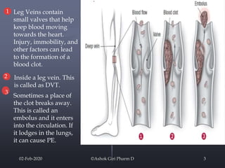 Deep Vein Thrombosis | PPT