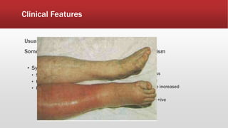 DVT | PPTX