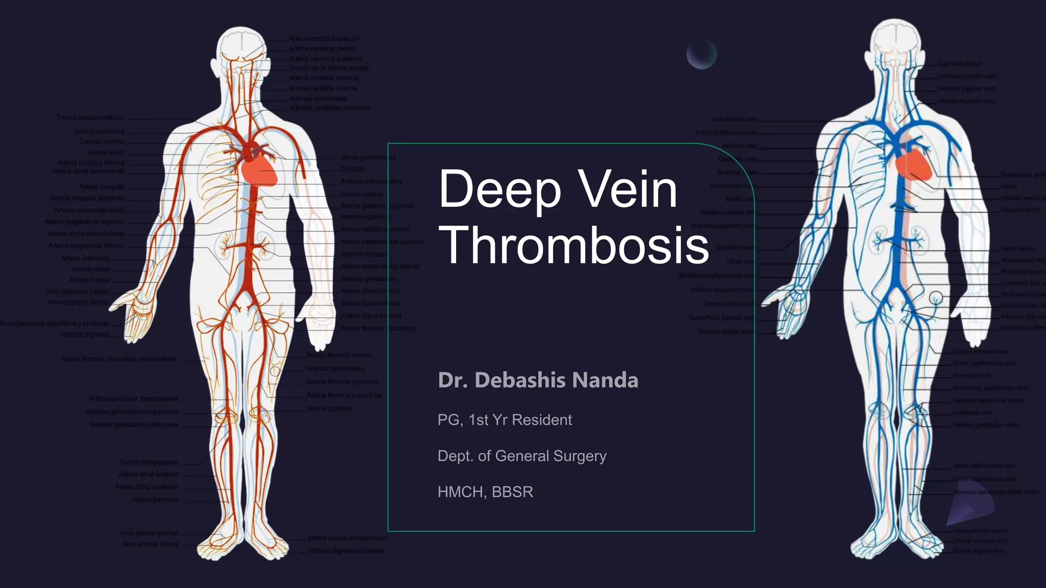 DVT( Deep Vein Thrombosis) | PPT