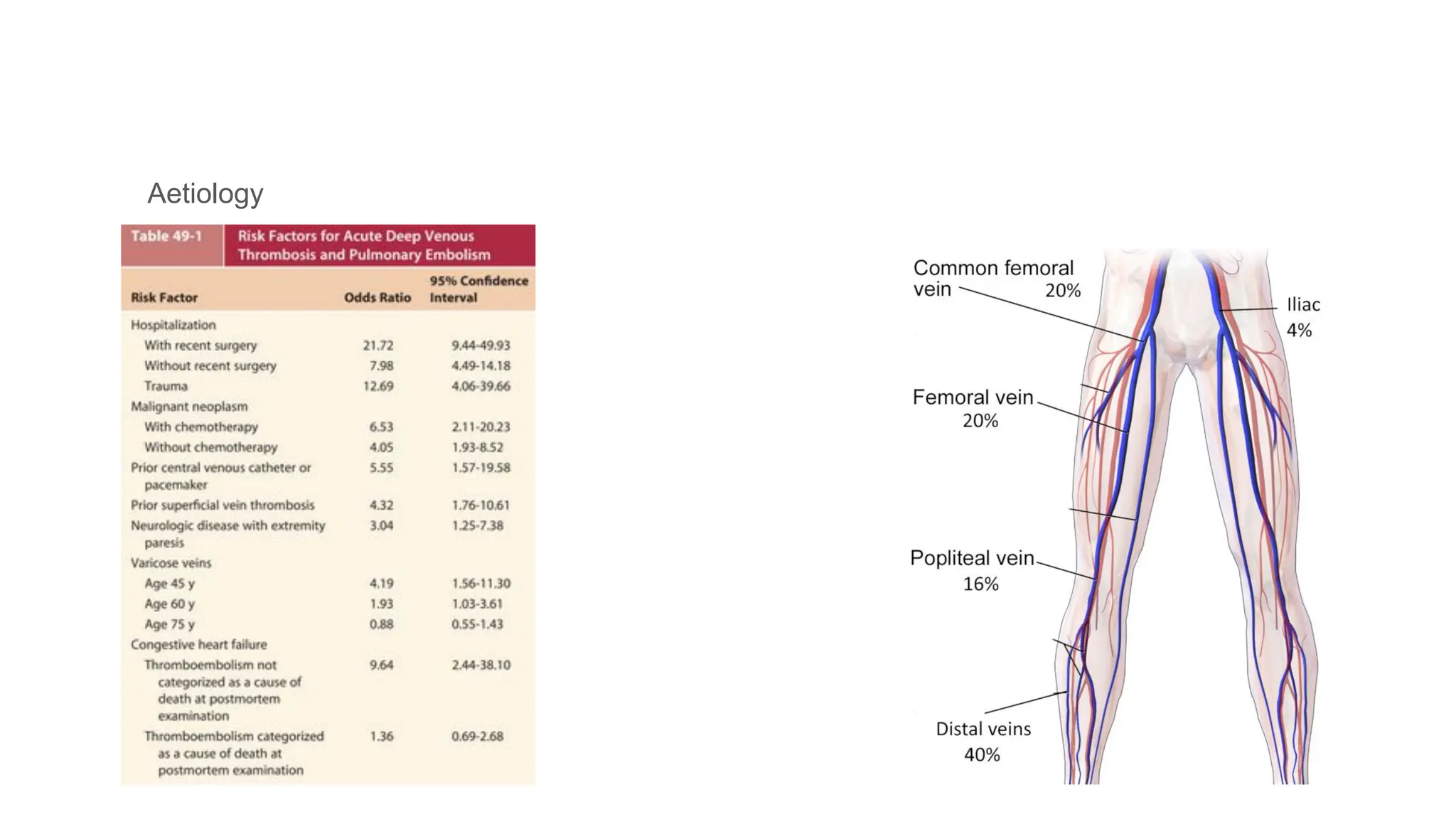 Deep vein thrombosis, etiology, diagnosis | PDF