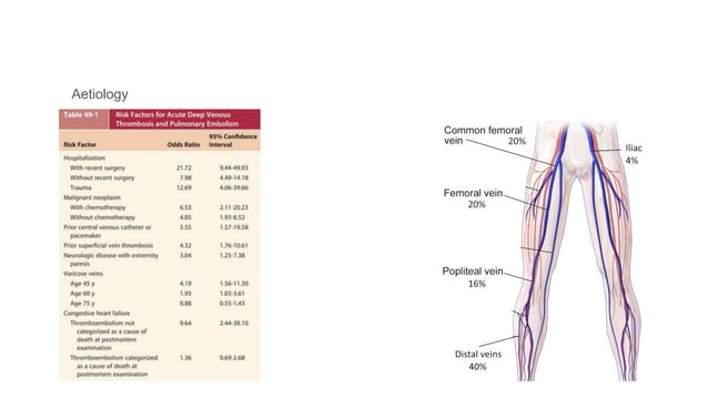 Deep vein thrombosis, etiology, diagnosis | PDF