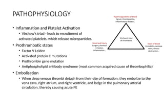 Deep venous thrombosis - detailed view, harrison | PPTX