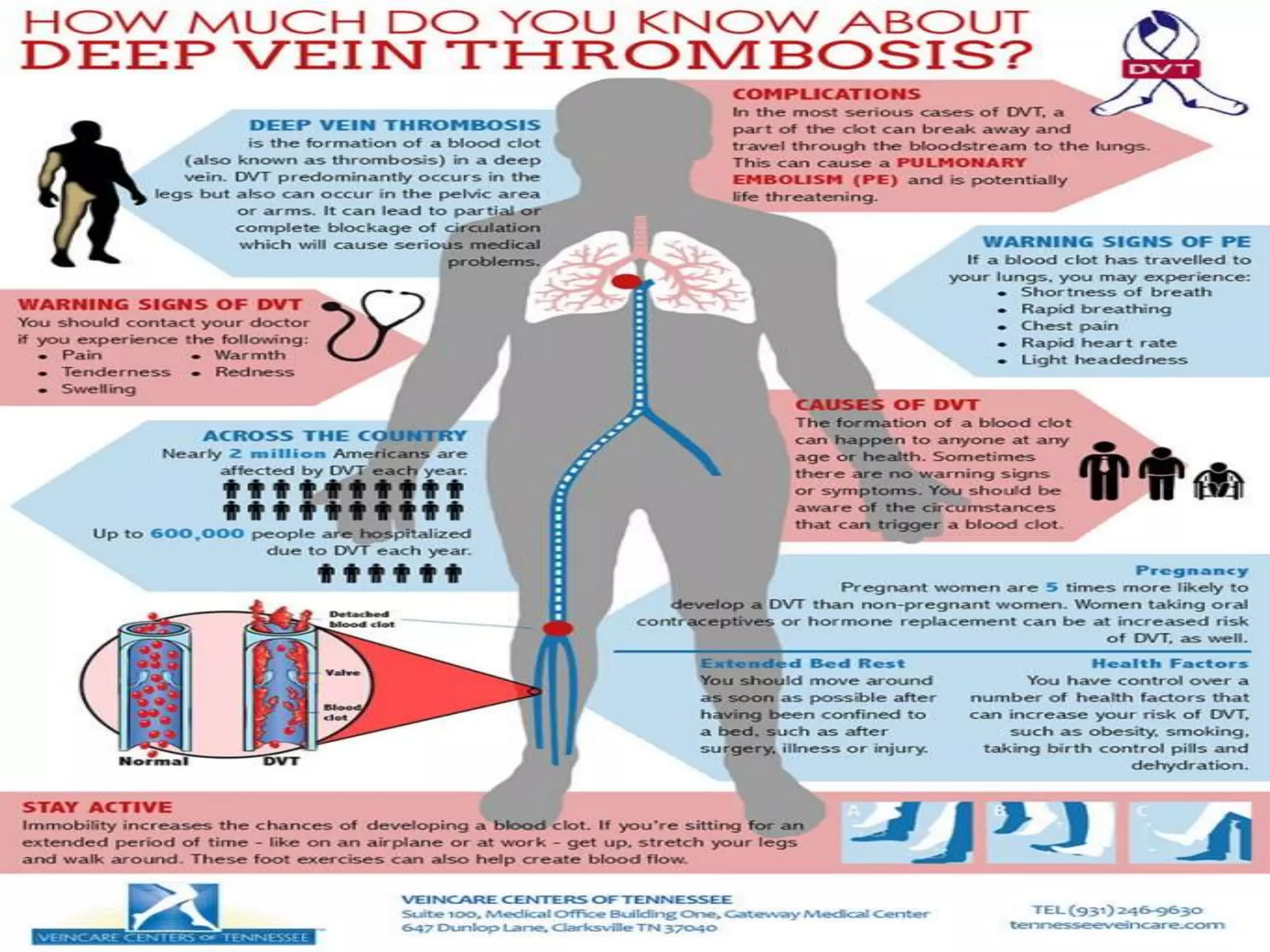 DEEP VEIN THROMBOSIS DVT | PPT