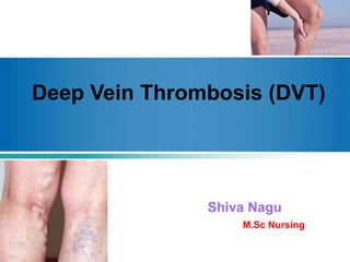 DEEP VEIN THROMBOSIS DVT | PPT