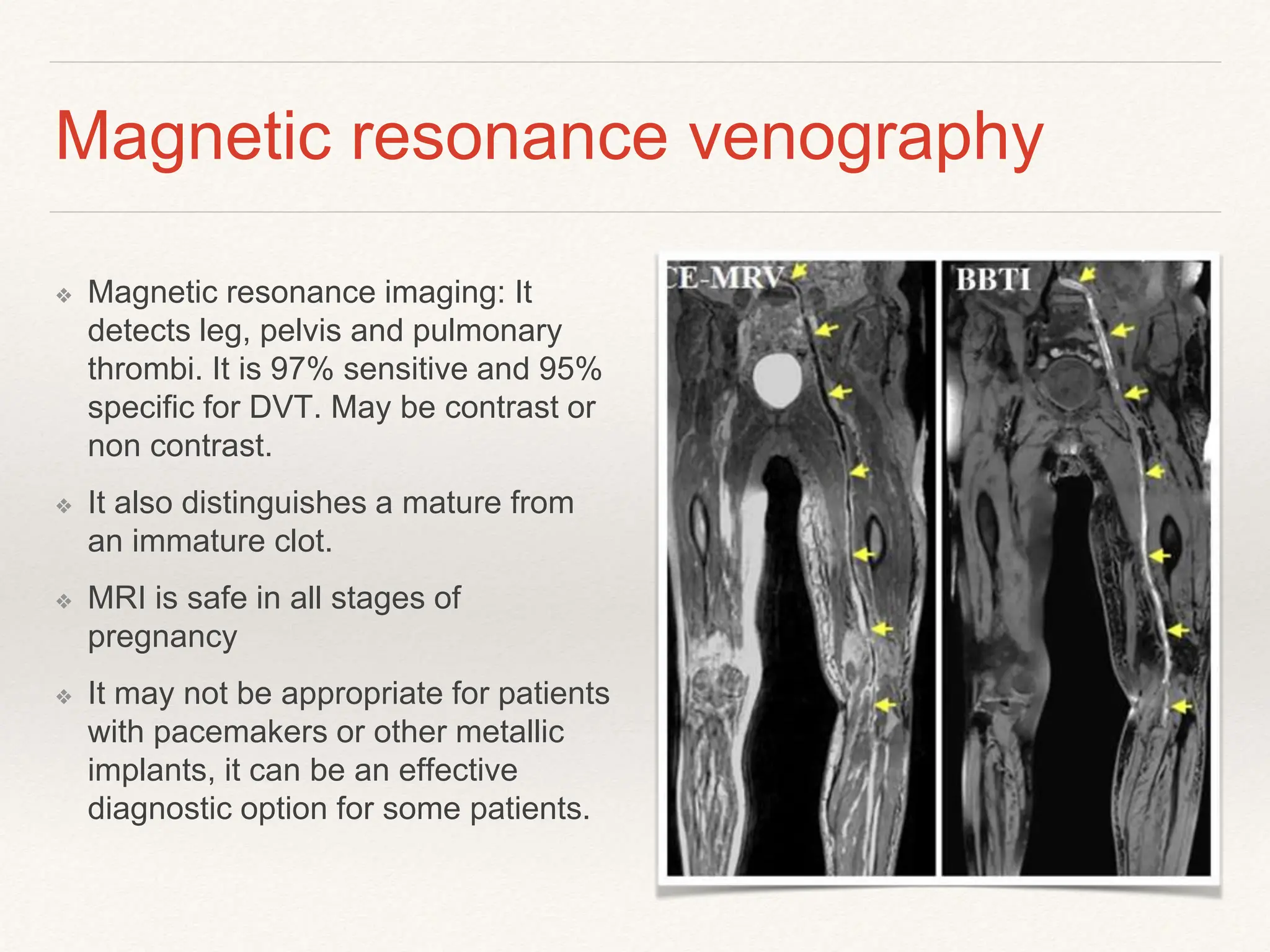 Risk Factors, Prevention, Management of DVT | PPTX