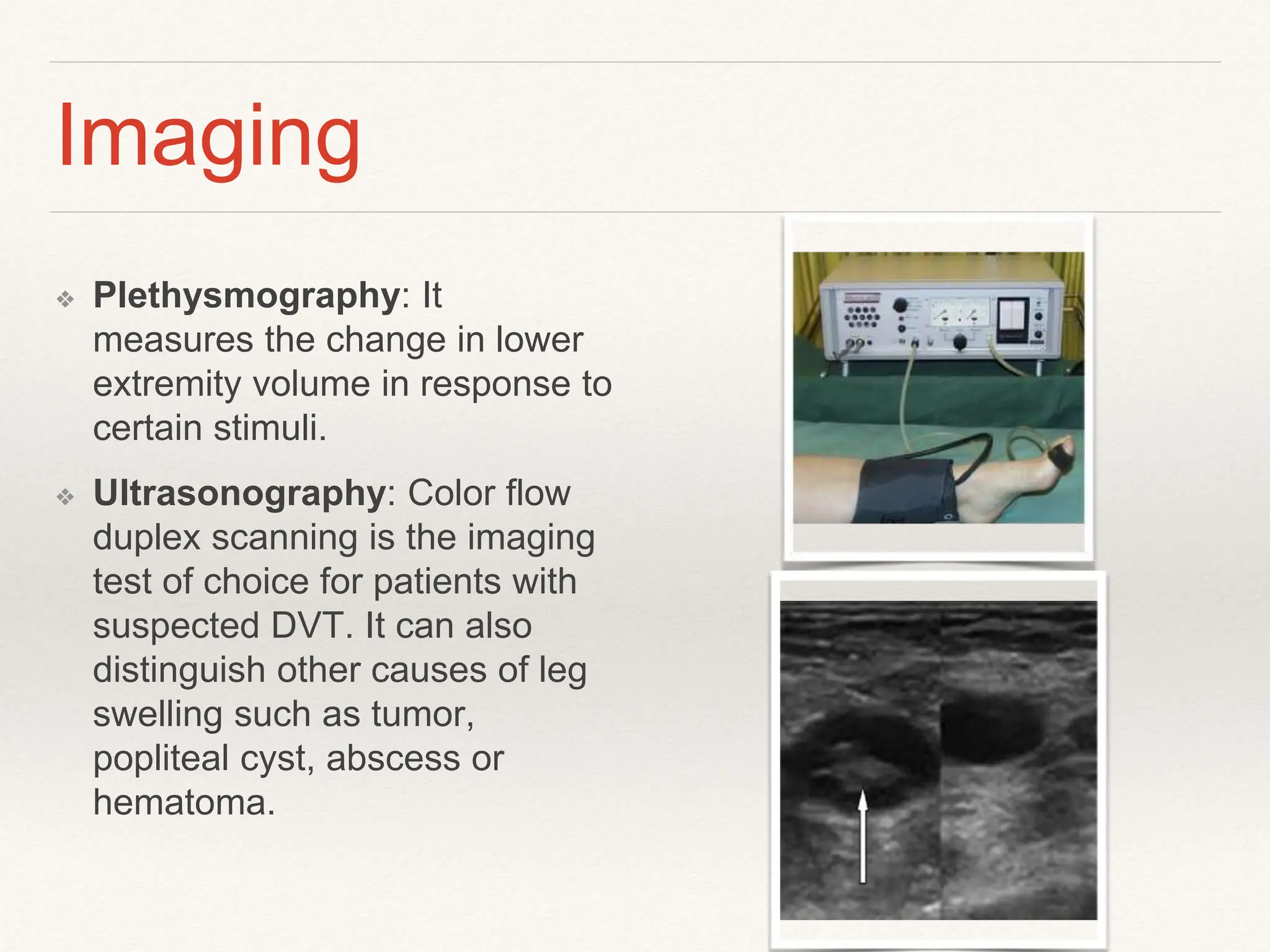 Risk Factors, Prevention, Management of DVT | PPTX