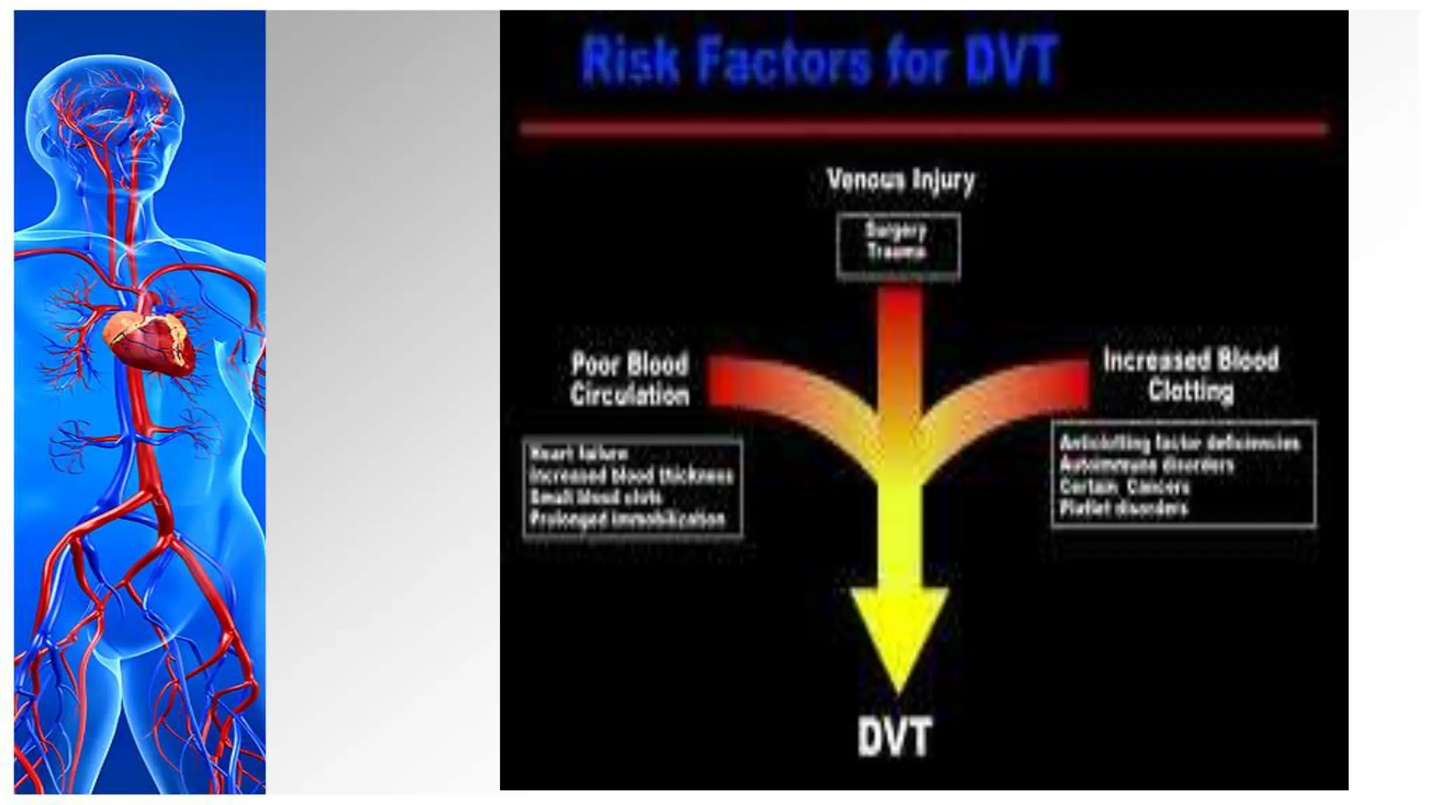 DVT and Vericose Vein and it causes and treatment | PPTX