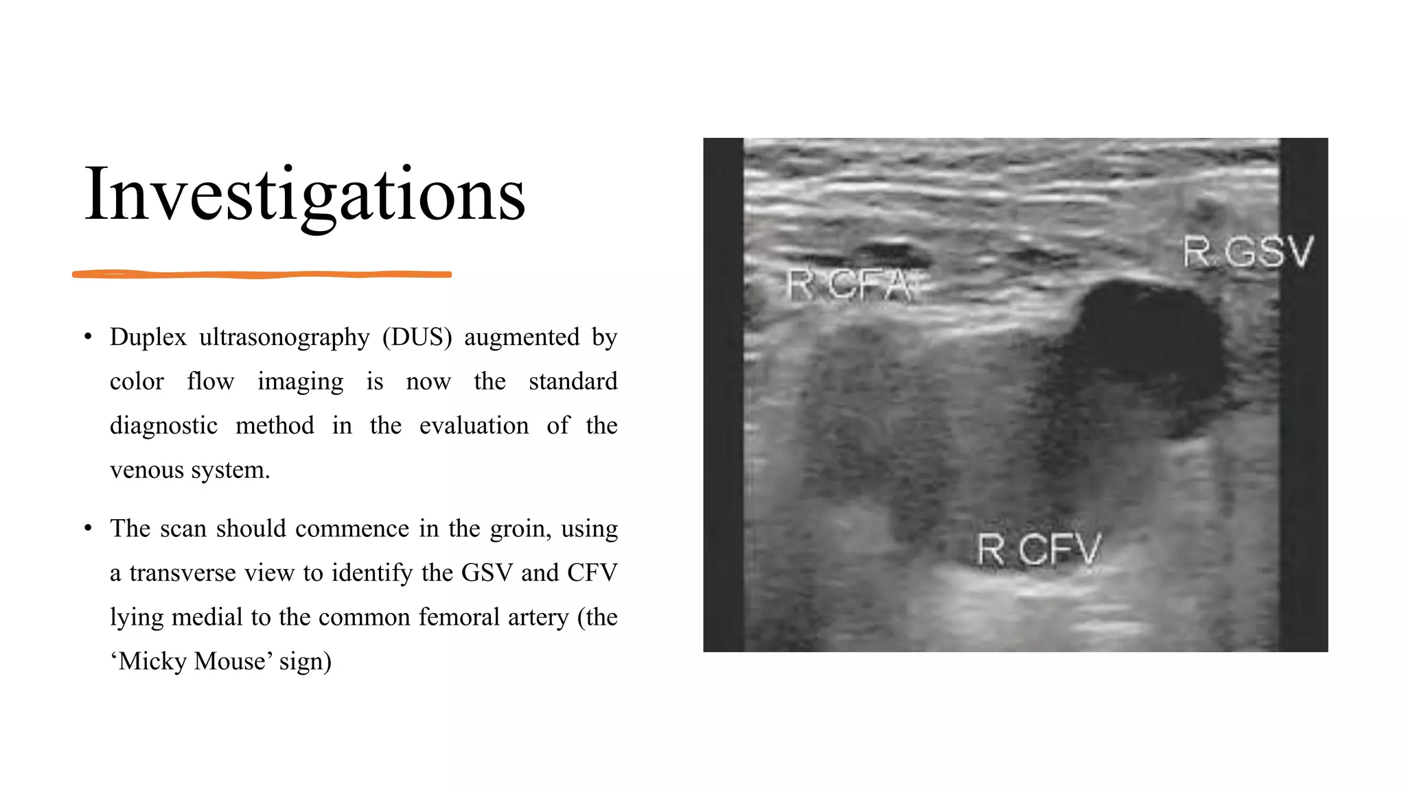 Varicose Veins and Deep Vein Thrombosis | PPTX