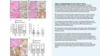 DVT in Cancer & Febrile Neutropenia in Oncology | PPTX