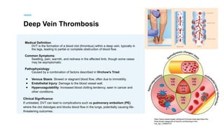 DVT in Cancer & Febrile Neutropenia in Oncology | PPTX