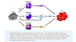 DVT in Cancer & Febrile Neutropenia in Oncology | PPT