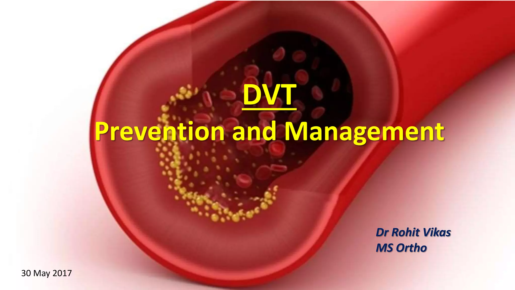DVT PROPHYLAXIS IN ORTHOPAEDICS | PPTX
