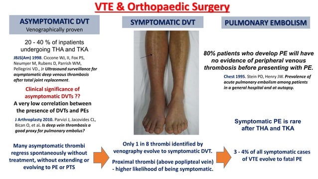 DVT PROPHYLAXIS IN ORTHOPAEDICS | PPTX | Blood Disorders | Diseases and ...